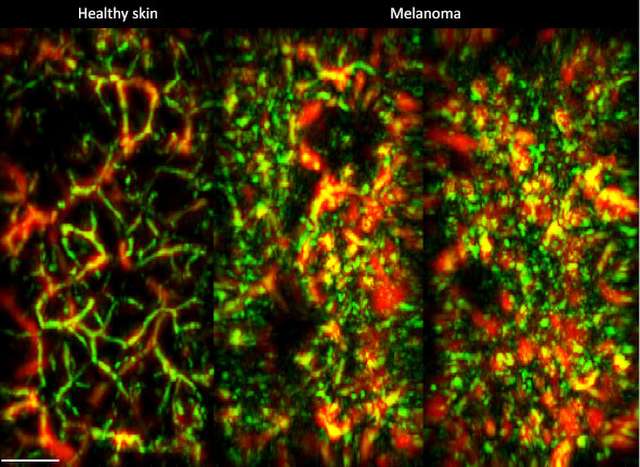 Helmholtz Imaging CONNECT - Fast optoacoustic rasterscanning mesoscopy