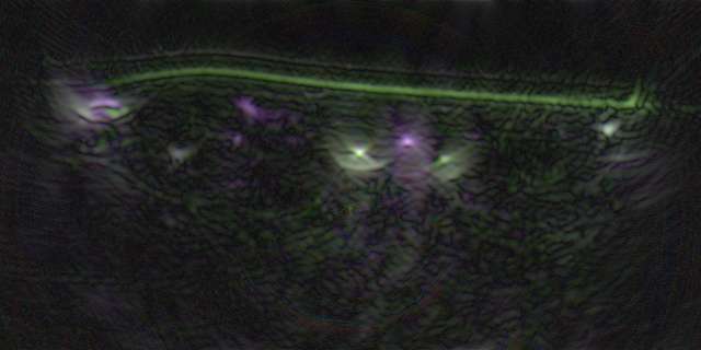 Helmholtz Imaging CONNECT - Photoacoustic Imaging